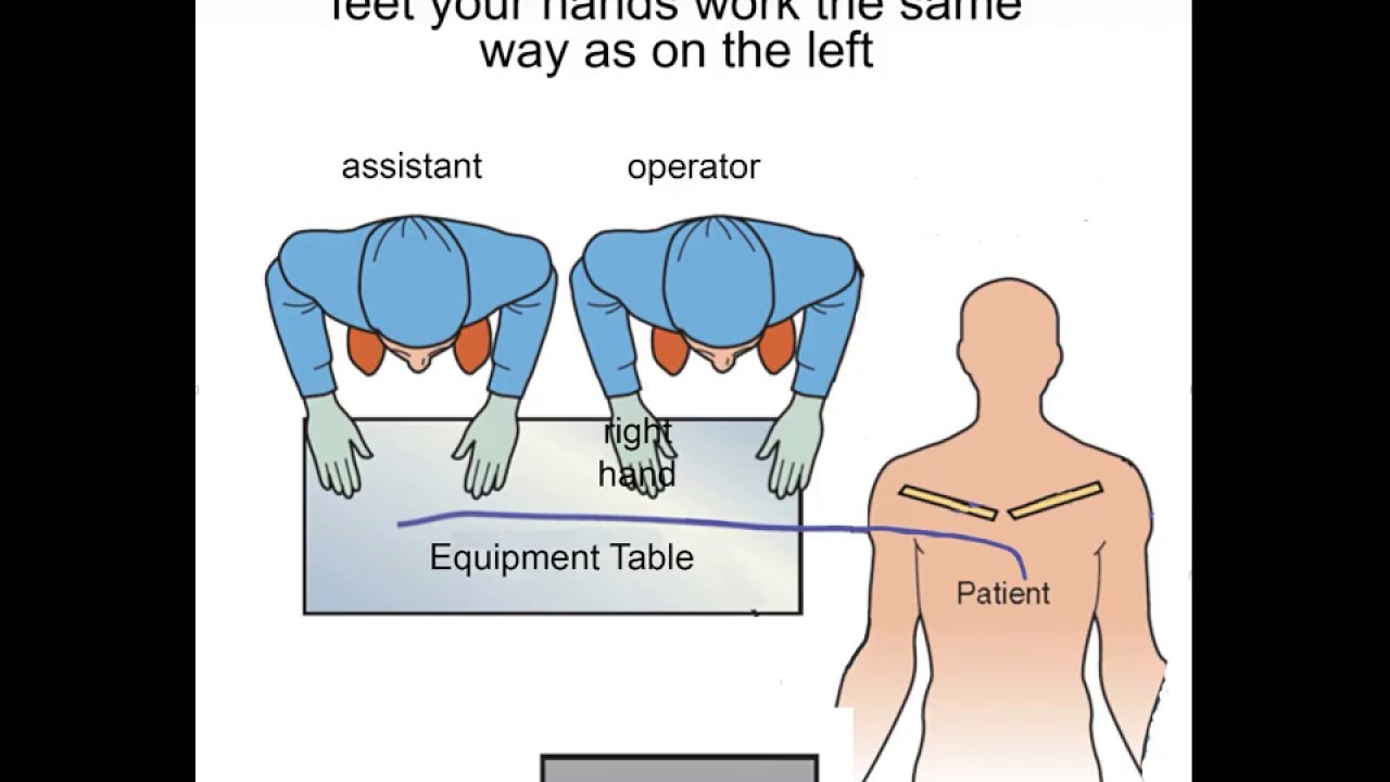 How to implant an LV lead from the Rt Side Step by step narrated 2019 ...