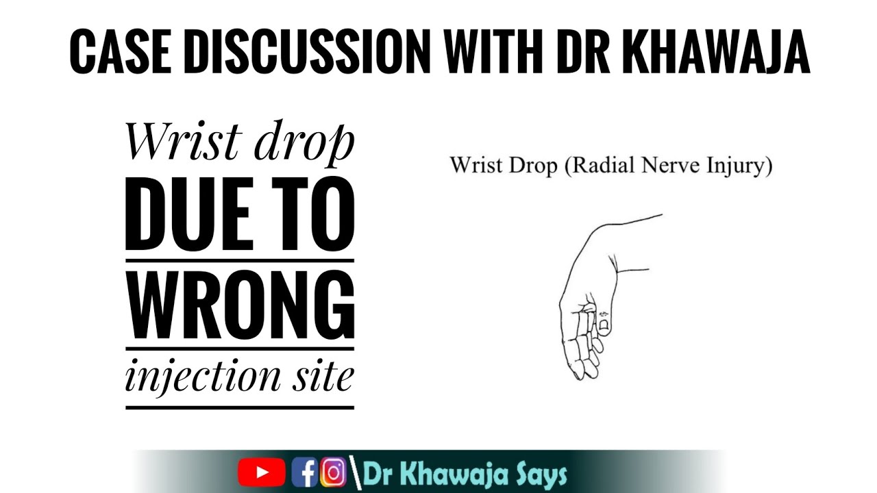Case Discussion of wrist drop/Radial nerve injury/Ideal injection site ...