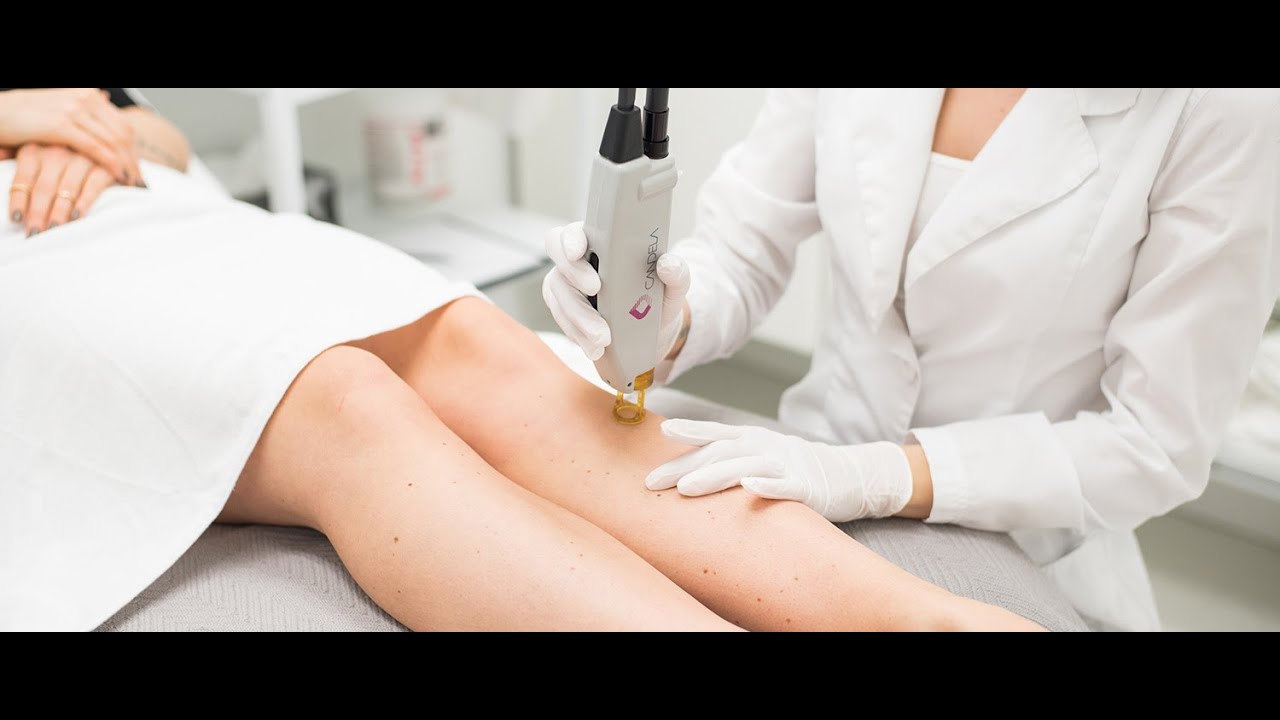 Certified Laser Hair Removal Technician - YouTube