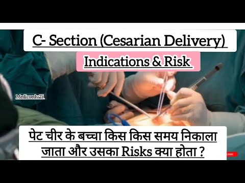 Indications Of Cesarean Section // Risks of C- Section - YouTube