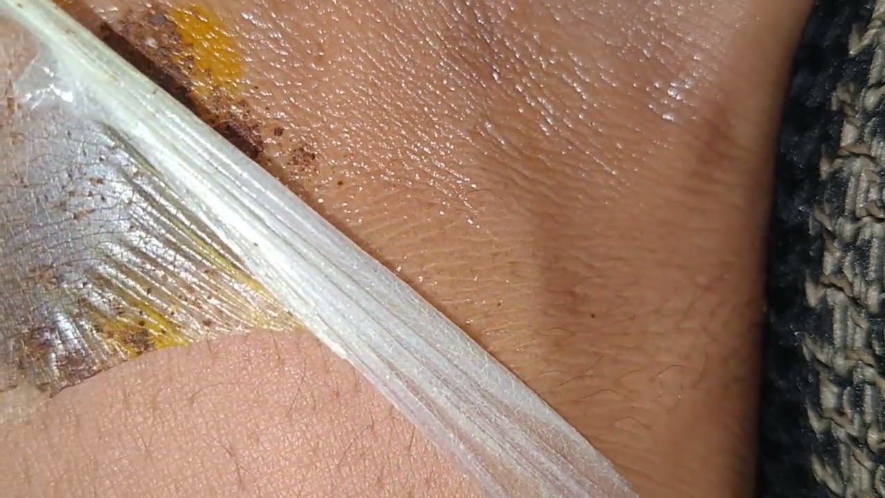 MY HANDS CHANGE SKIN - YouTube