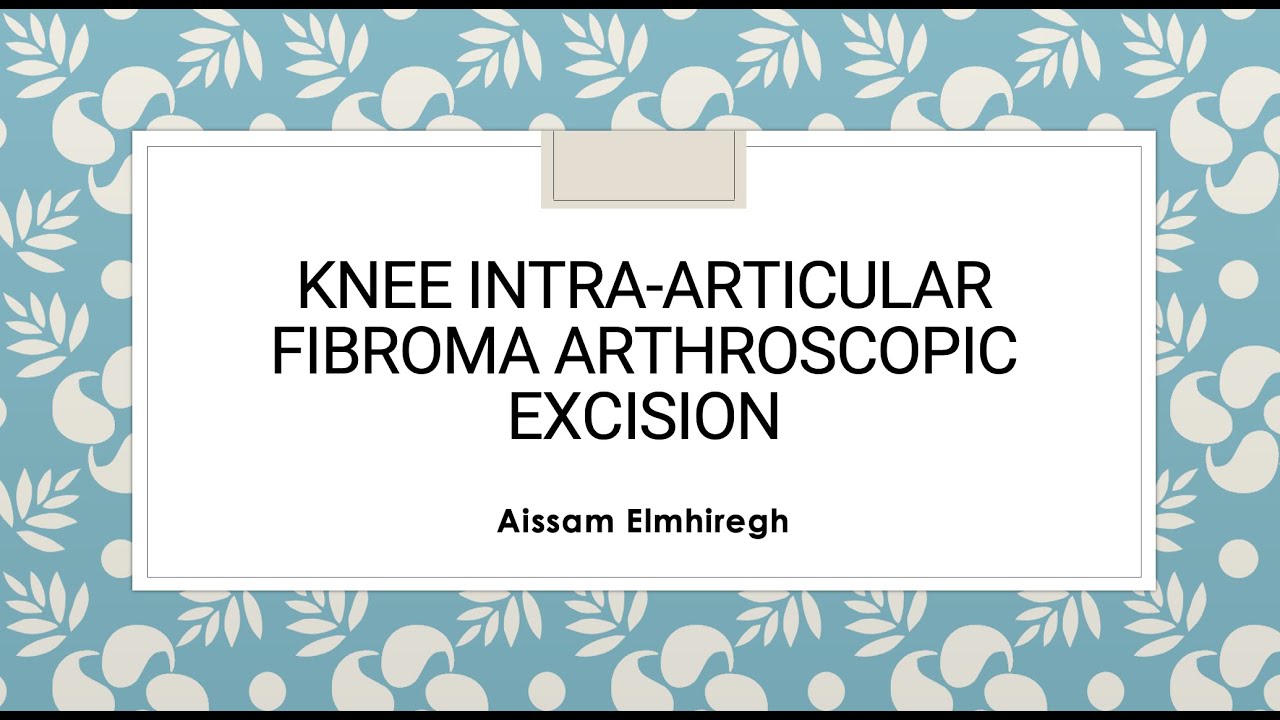 Knee intra-articular fibroma arthroscopic excision - YouTube