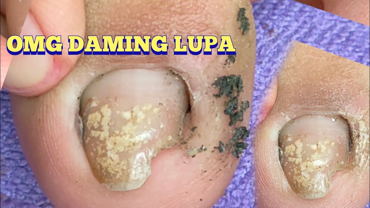 THE SOIL GETTING ON THE NAILS STINKS. - YouTube