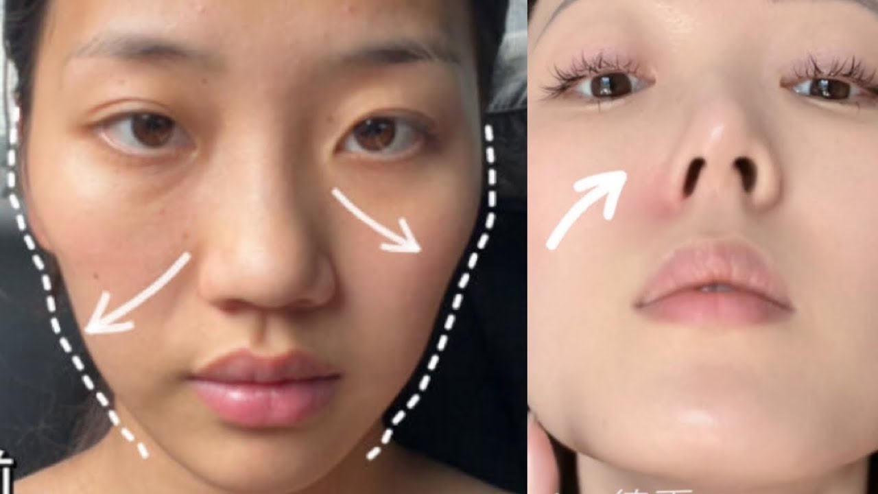 5 MINS SLIM STAIGHT NOSE MASSAGE | GET SHARP NOSE, HOOKED NOSE REDUCTION, REMOVE NOSE HUMP - YouTube