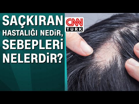 Saçkıran hastalığı nedir, sebepleri nelerdir?