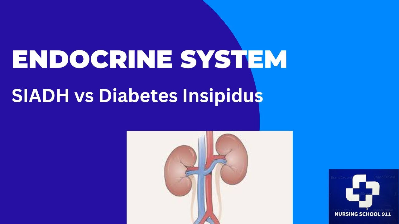 SIADH vs. DI - YouTube