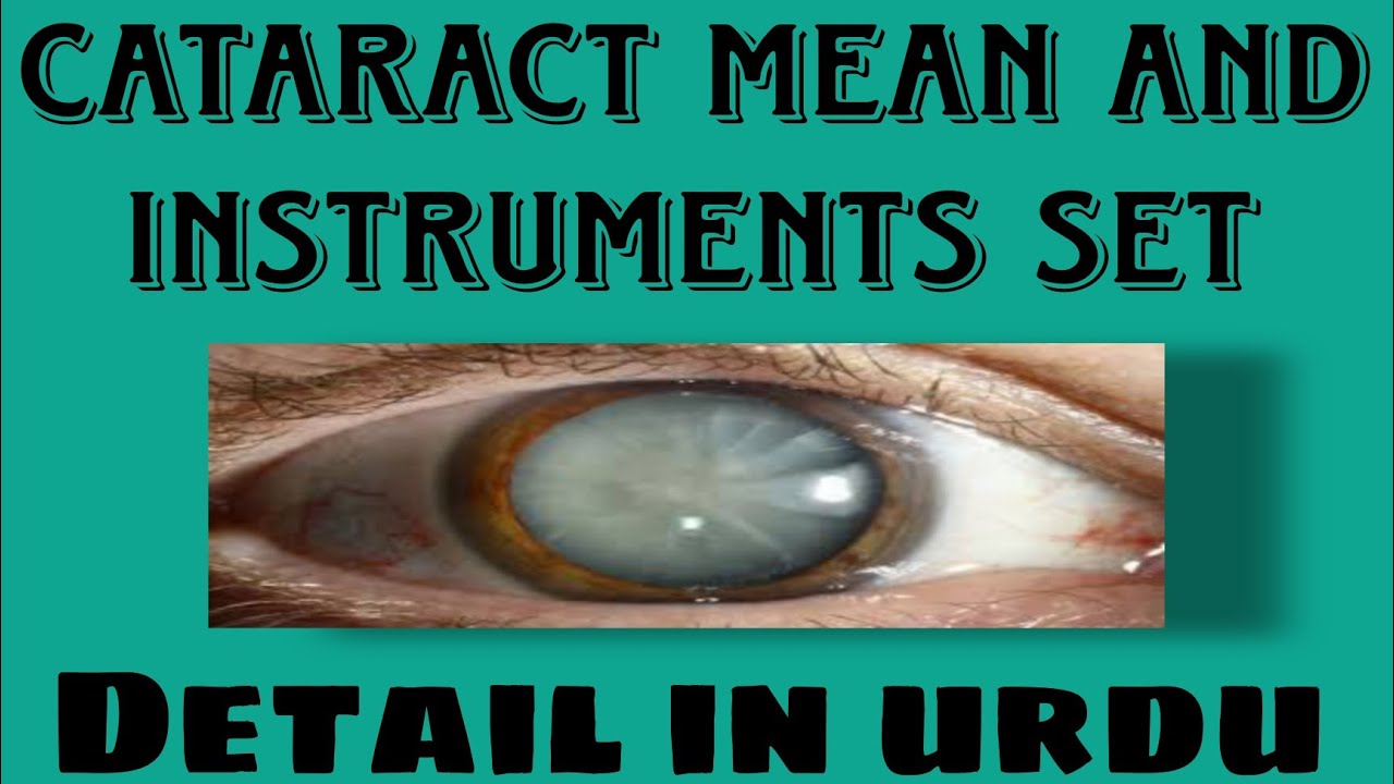 Cataract mean? |Cataract instruments set? |Full detail in urdu.# ...
