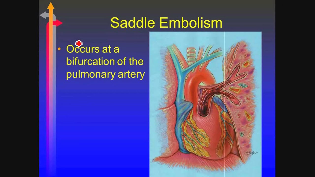 RSPT 1140 Module D Part II - YouTube