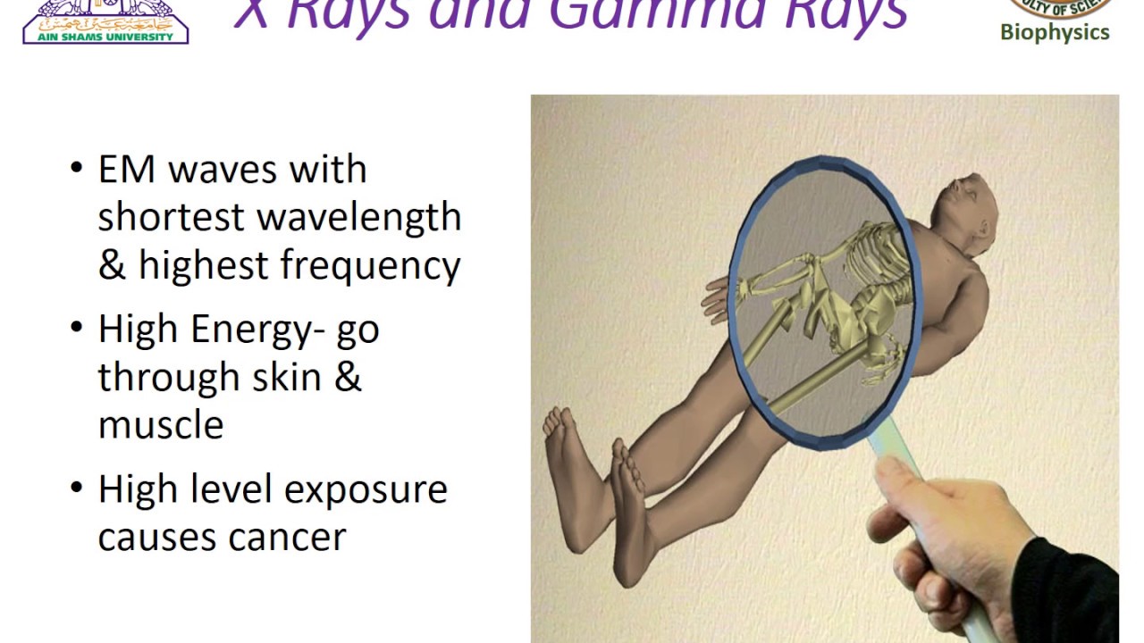 Biomedical applications of X-ray - YouTube