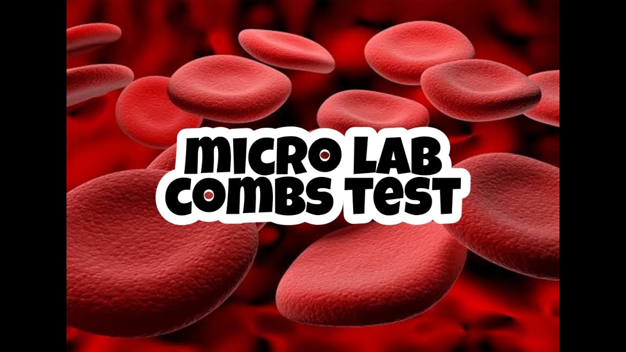 Microbiology Lab | Coombs Test - YouTube