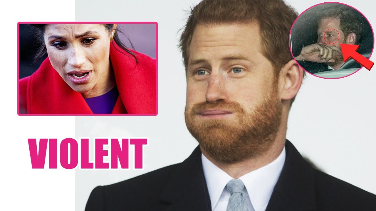 Meg Grabbed Haz By The Collar As BRUISED FACE Haz Sticking Head Out Of ...