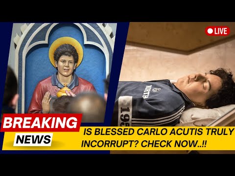 Is Carlo Acutis Incorrupt? Here is the Truth