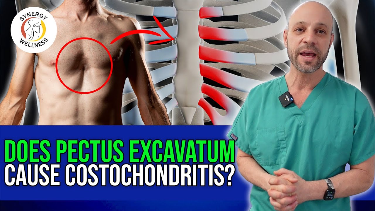 Does Pectus Excavatum or Carinatum Cause Costochondritis? - YouTube