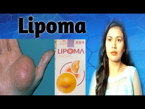 lipoma lump,lipoma lump in hindi, Lipoma Drops in hindi,Lipoma Drops ...