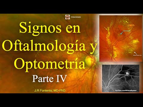 Signos en Oftalmología y Optometría (Parte IV). - YouTube