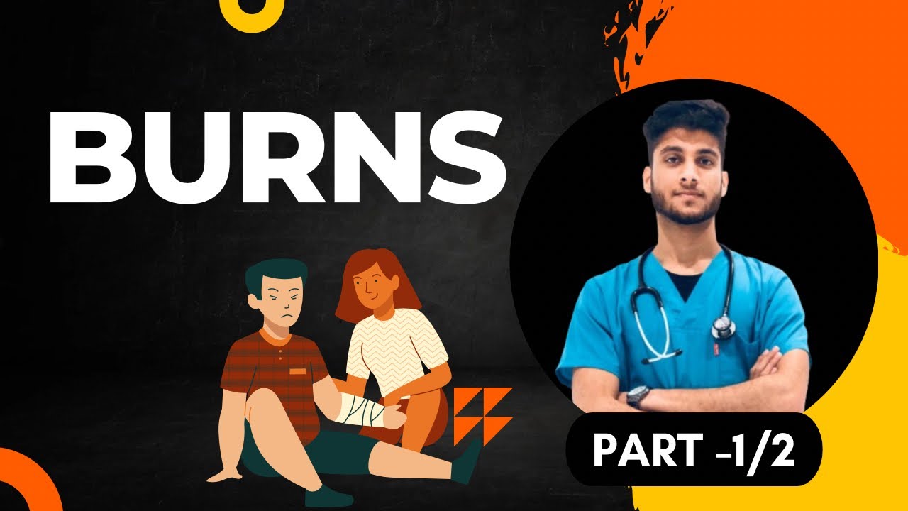 Burns | types | rule of nine & parkland formula | management | part-1/2 ...