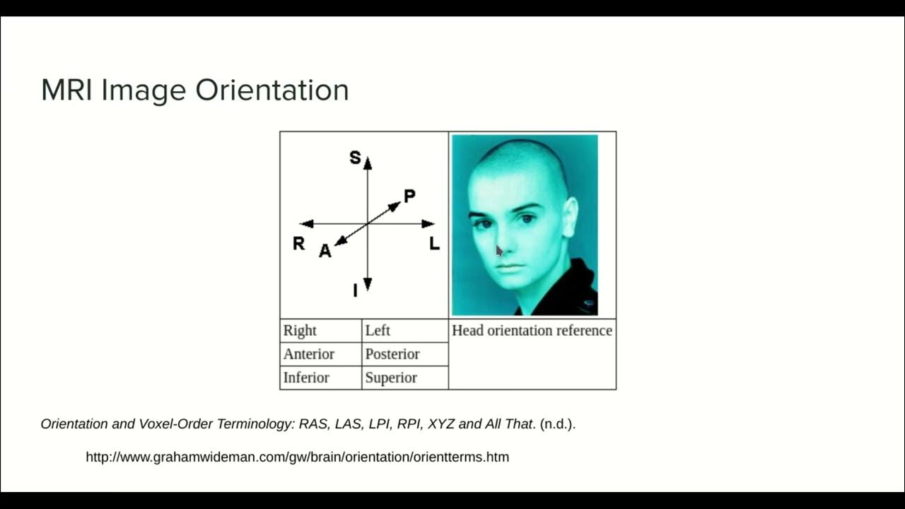 1.0 - MRI image orientation with ANTsPy - Course MRI preprocessing with Python - YouTube