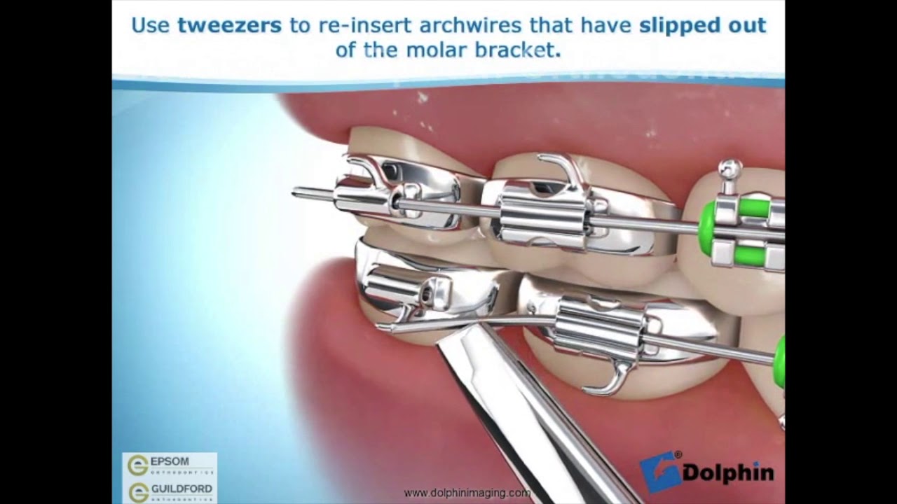 Tips for Poking Wires - YouTube