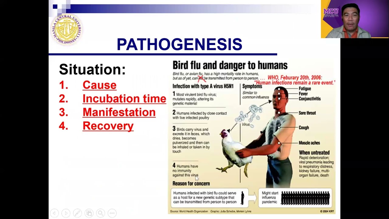TOPIC 6 Pathogenesis and Pathognomomnic Sign 2 1 3 18 22 - YouTube