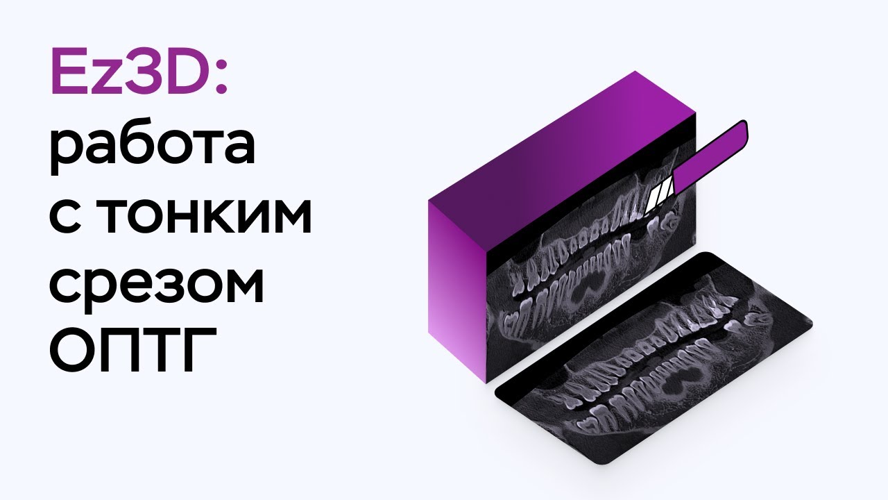 Возможности программы Ez3D: работа с тонким срезом ОПТГ - YouTube