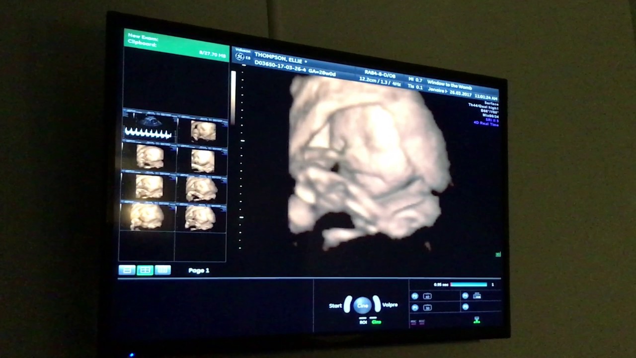Ellie & Jamie 28 Weeks: 4D Baby Scan - YouTube