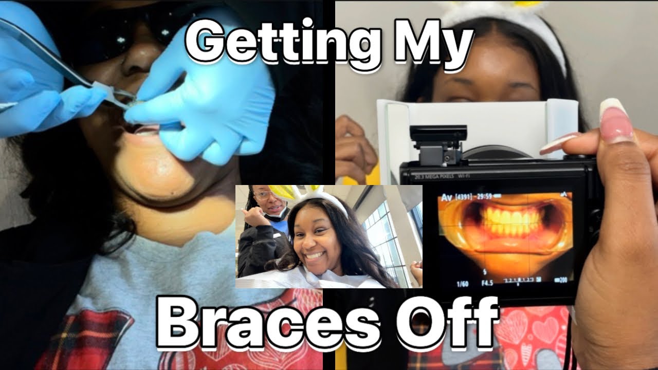 Yay! I GOT MY BRACES OFF! Watch THIS !! - YouTube