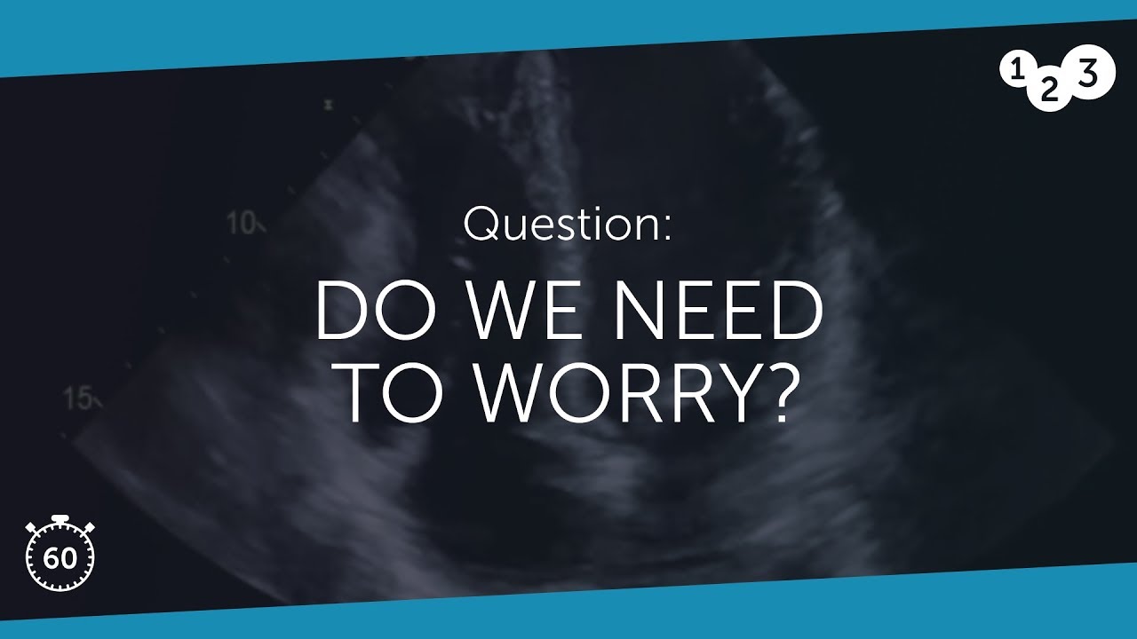 60 Seconds of Echo Teaching Question: Do we need to worry? - YouTube