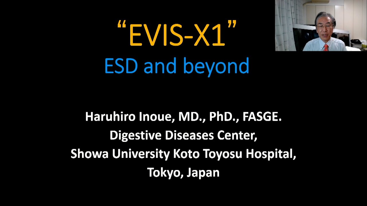 Challenges of third and forth space endoscopy. Haruhiro Inoue - YouTube