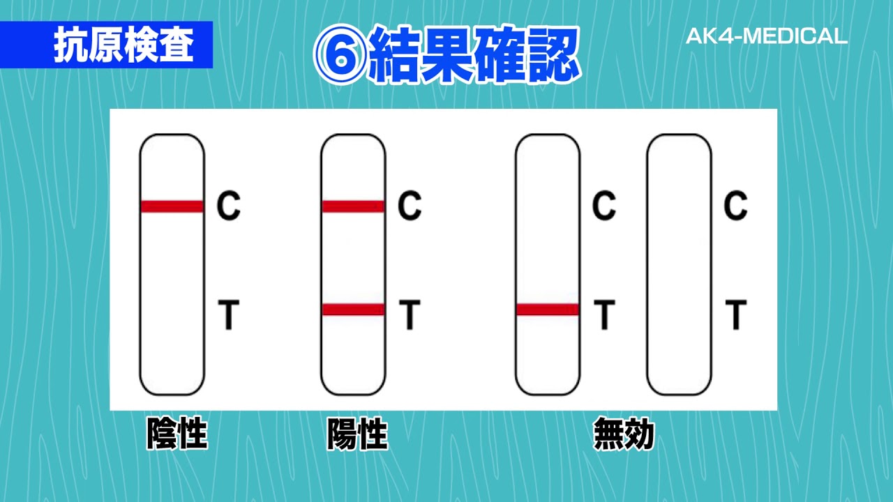 AK4-MEDICAL 抗原・抗体検査キット 20201215 - YouTube