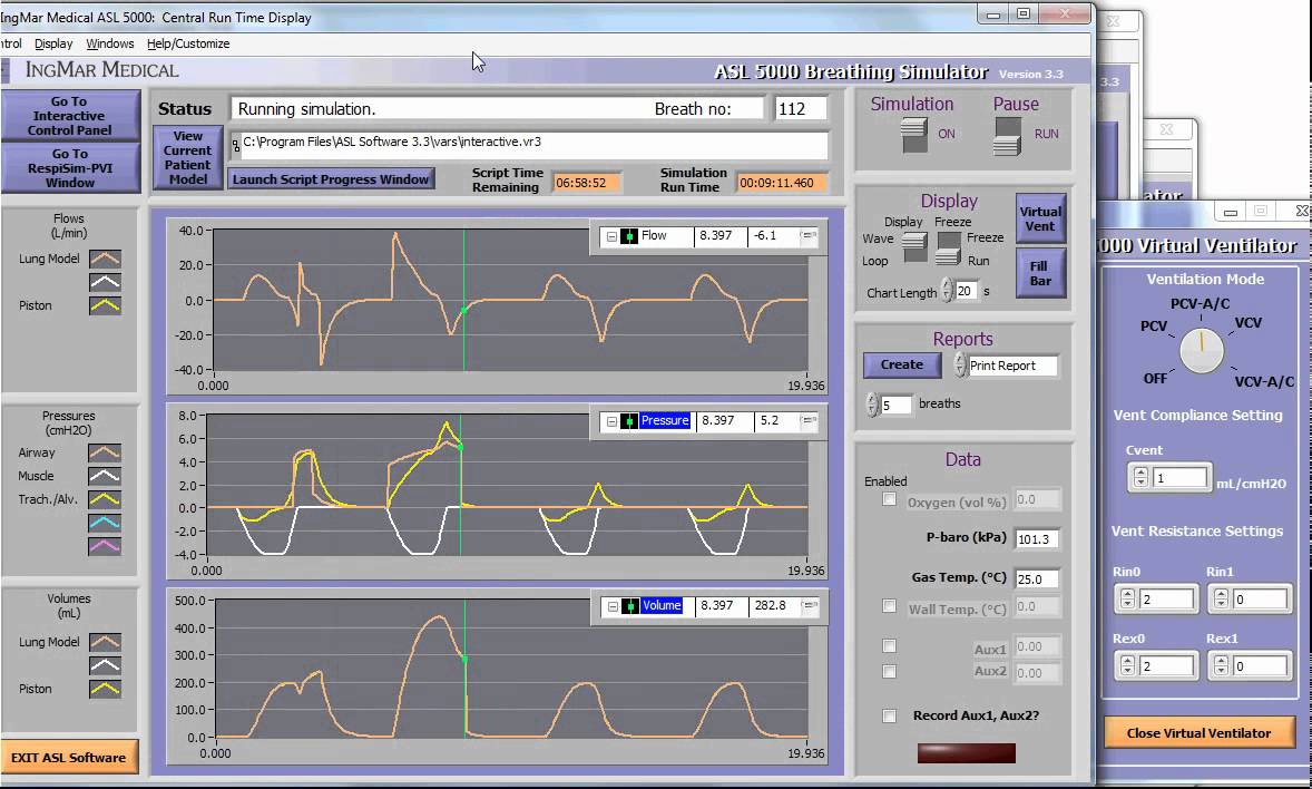 ASL 5000 Software - Virtual Ventilator Dyssynchrony - YouTube