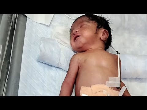 Icu and. Nicu care and treatment in NICU picu NICU - YouTube