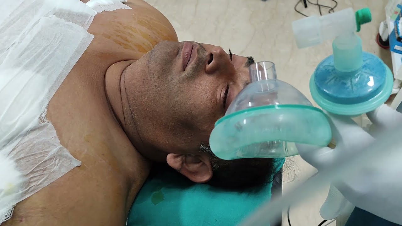 Man Coming out of General Anesthesia After Surgery !! Dr. Prashant ...