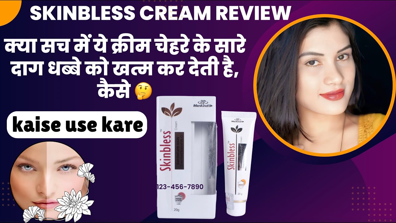Skinbless Cream Review | Skinbless Cream Side Effects | Kaise Use Kare ...