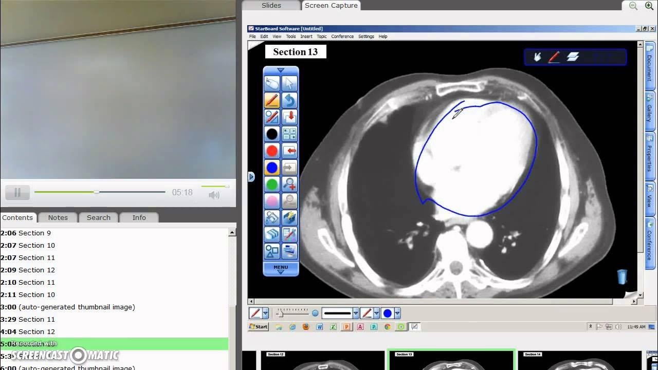 CT Vascular System - YouTube