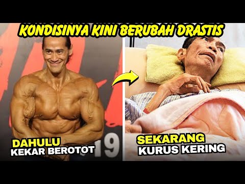 Tak ada yang menyangka, 5 Artis bertubuh kekar ini alami sakit parah hingga tersisa kulit dan Tulang