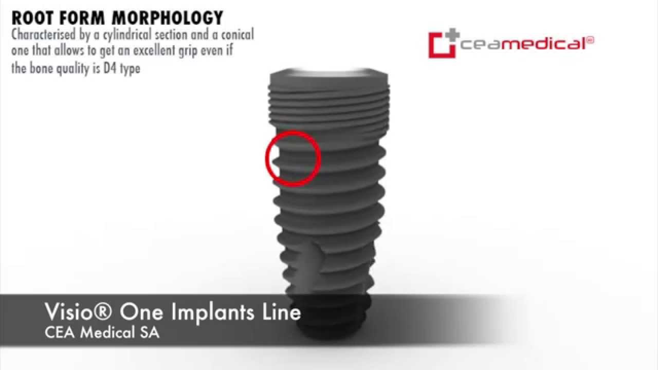 CEA Medical SA - Visio One Implants Line 2015 - YouTube