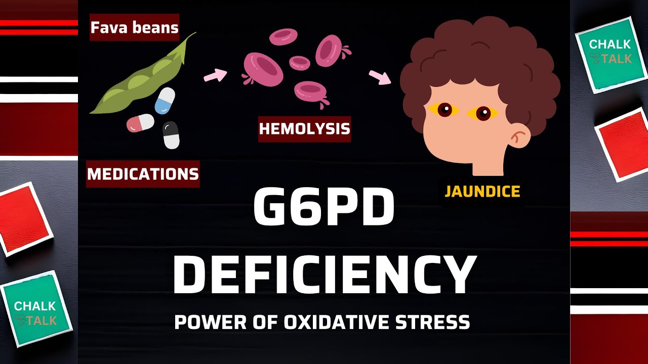 G6PD DEFICIENCY (GLUCOSE-6-PHOSPATE DEHYDROGENASE) - YouTube