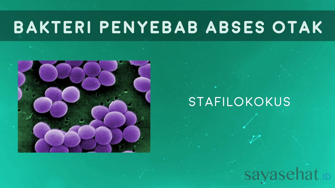 Abses Otak - YouTube