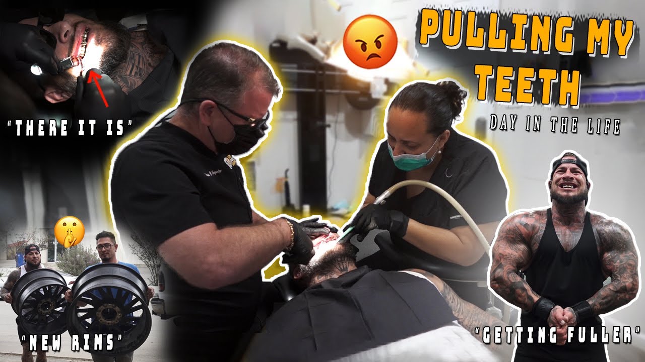 STAX GETS HIS WISDOM TEETH PULLED!! | New Stax Army Hat | Day in the ...