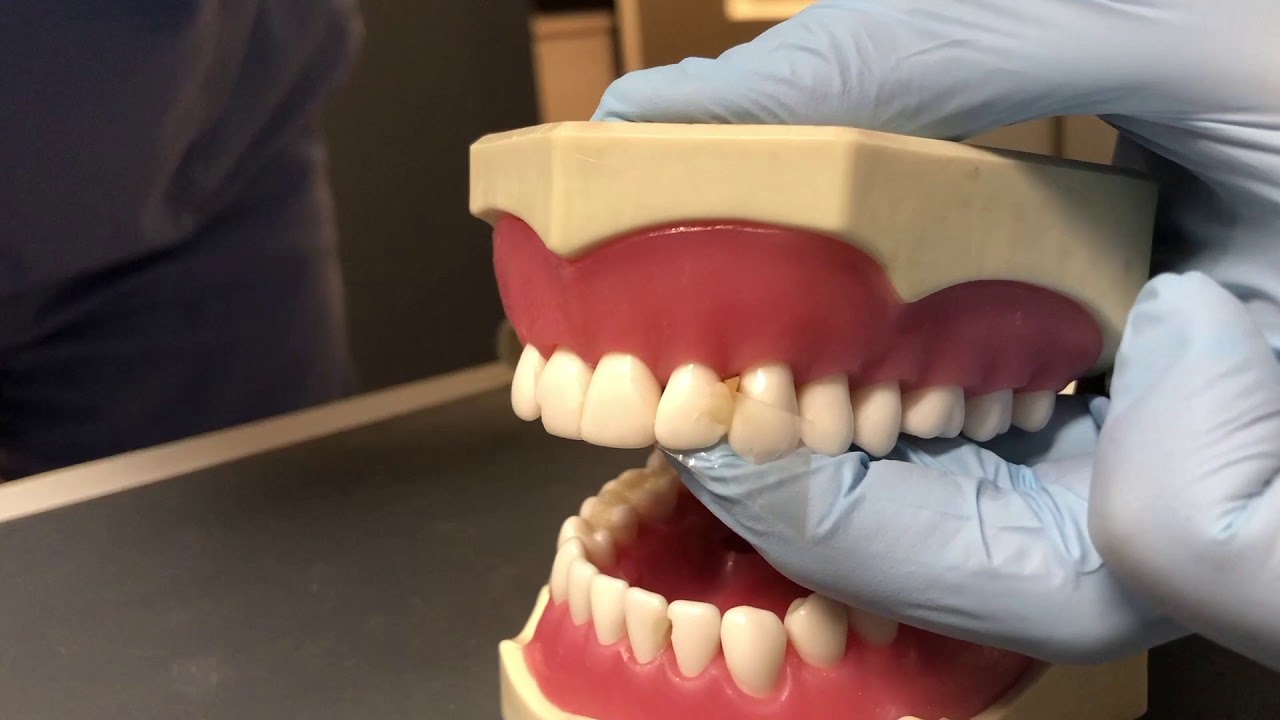 C Shape FLAT tip demonstration - YouTube