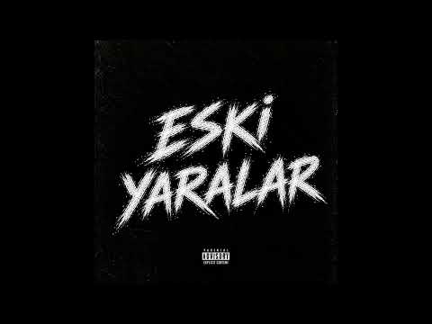 MERT KORKMAZ - ESKİ YARALAR (Official Audio)