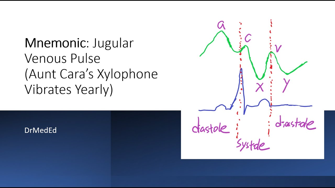Mnemonic: Jugular Venous Pulse Waveform (Aunt Cara's Xylophone Vibrates ...