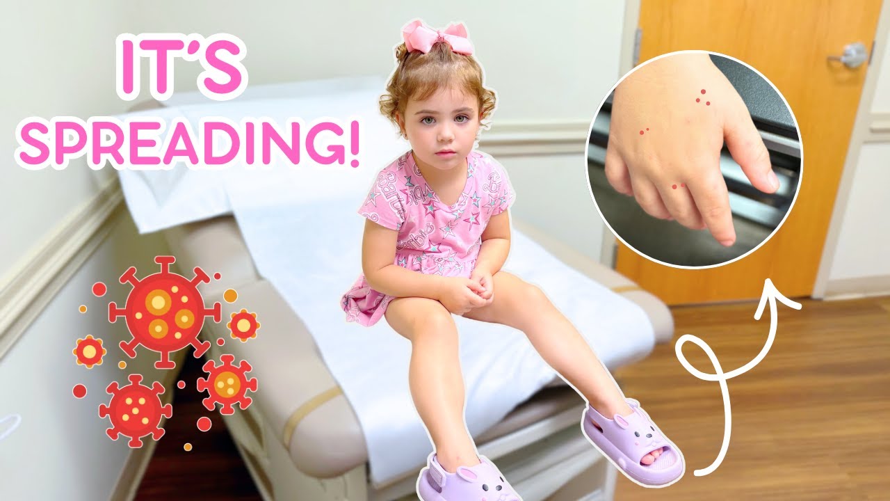 Toddler’s Rash Turns Out to Be Hand Foot & Mouth! | Urgent Care Visit ...