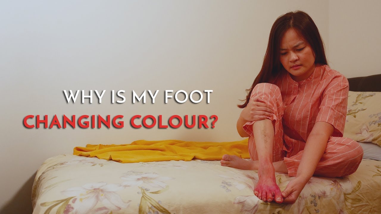 Why is my foot changing colour? - Podiatrist Georgina Tay, East Coast ...
