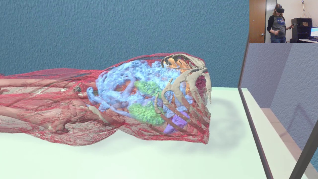 VR Reconstruction of a Vascular CT Runoff - YouTube