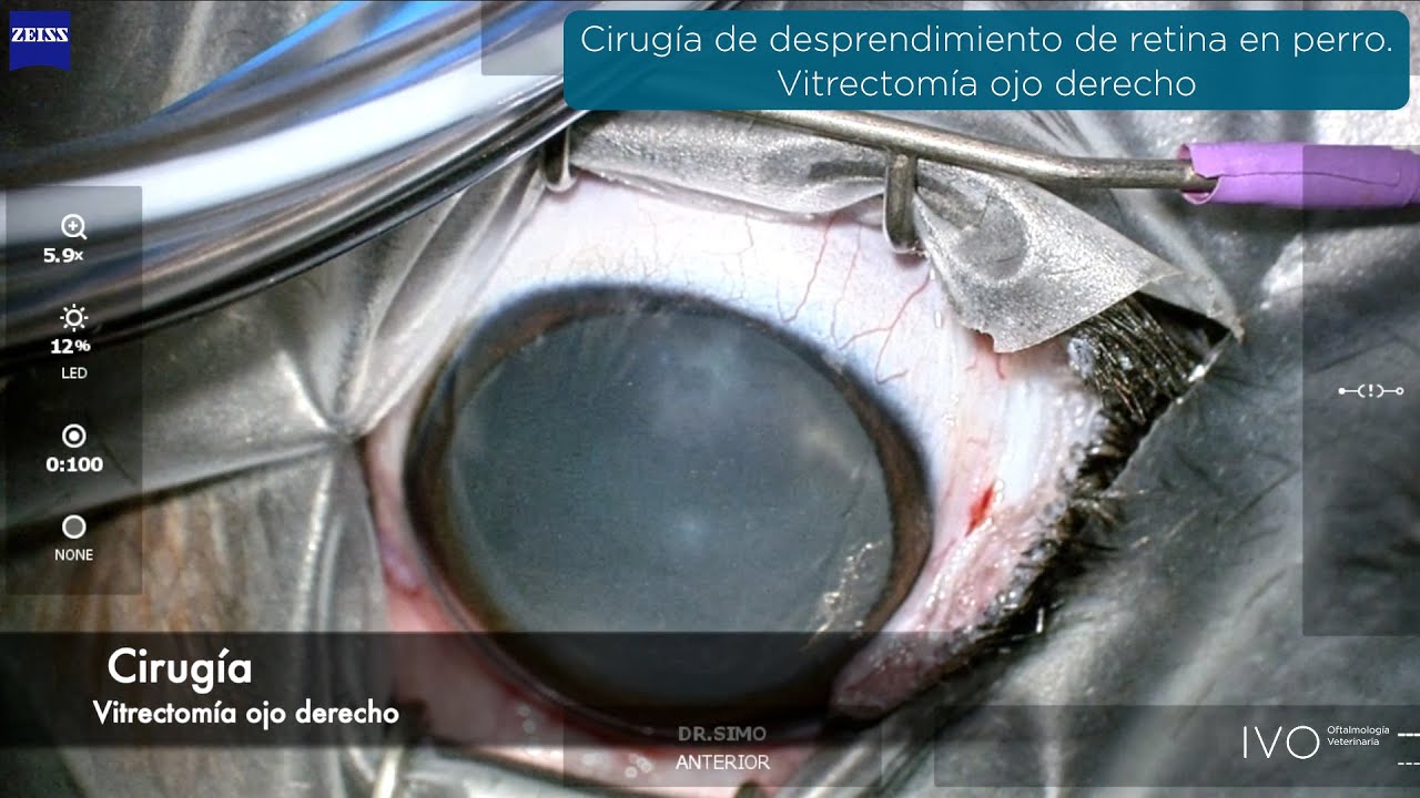 Cirugía de desprendimiento de retina perro. Vitrectomía ojo derecho ...