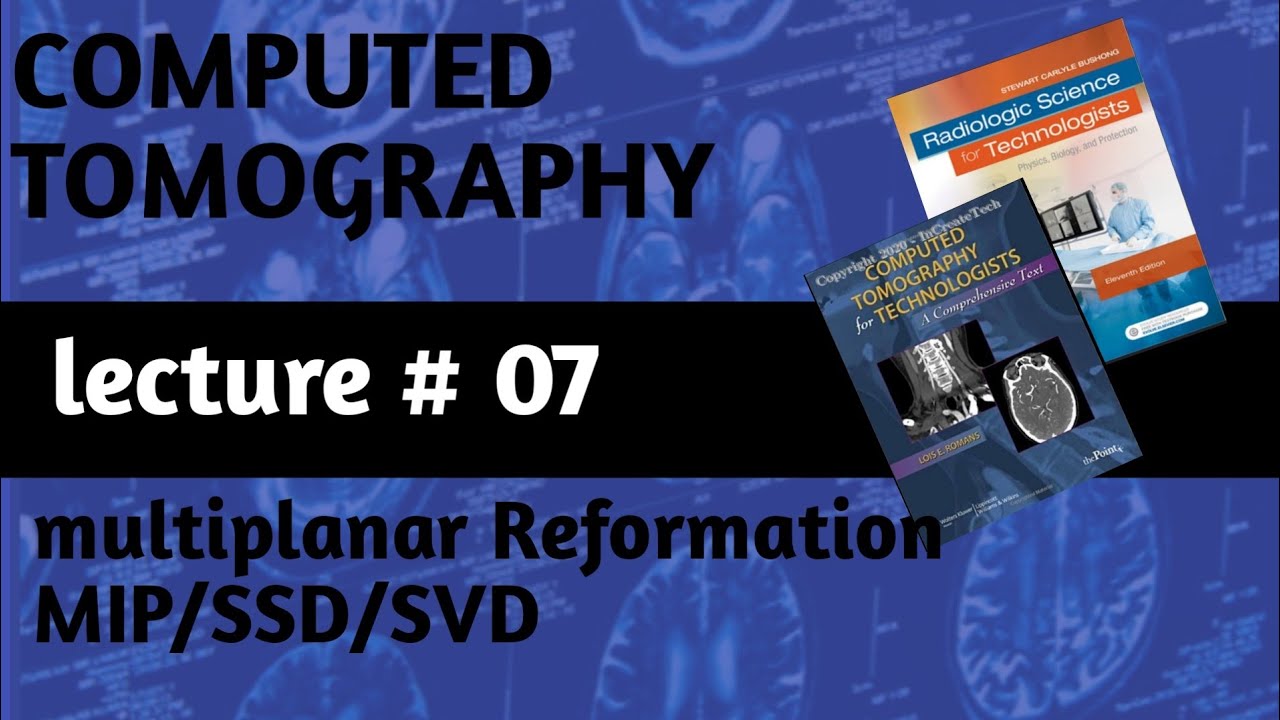 #multiplanarReformation/Maximum intensity projection/shaded surface ...