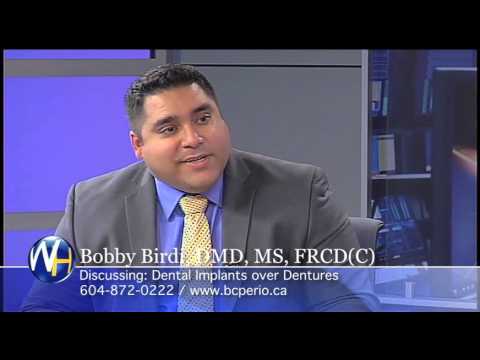 Dr. Bobby Birdi Explains Why Dental Implants over Dentures - YouTube