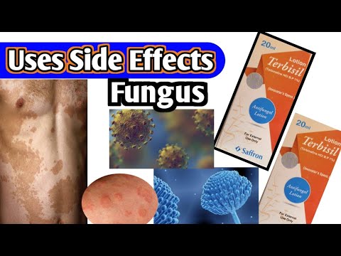 Terbisil Lotion Uses || #antifungal || How to use Terbinafen - YouTube