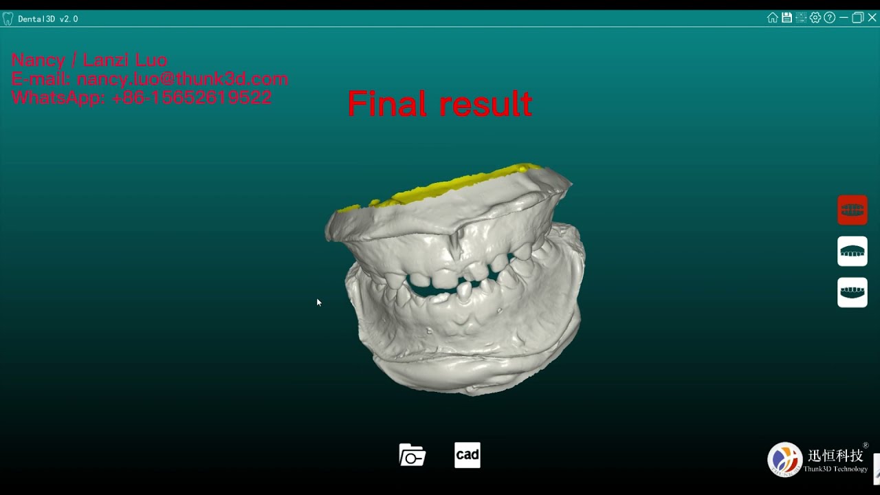 Lab dental 3D scanner with Occlusion - YouTube